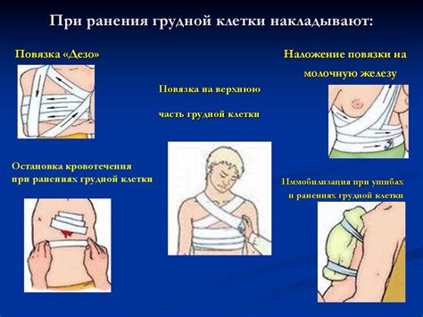 Ранения. Виды и характеристика ранений. Мероприятия первой помощи при ...