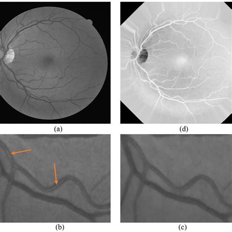 Vessel Classification Outcome Download Scientific Diagram