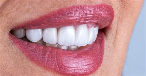 5 Consejos Para Cuidar Tus Dientes Y Encías Fuera De Casa