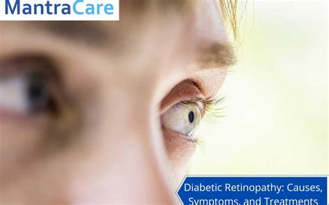 Diabetic Retinopathy Causes And Treatment How To Prevent Vision Loss