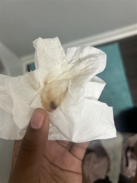 Is This Implatation Bleeding Rpregnancycare