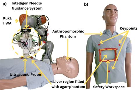 论文审查 Preliminary Evaluation Of An Ultrasound Guided Robotic System For Autonomous Percutaneous