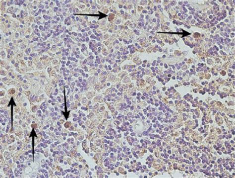Representative Photomicrograph Of The Sub Mandibular Lymph Node B At