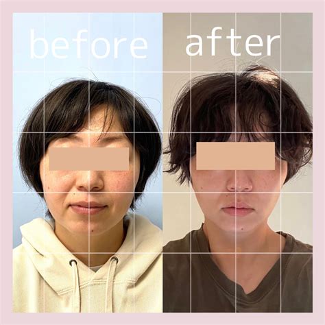 お客様のビフォーアフター 埼玉県和光市 小顔ケアサロンsoar〈ソア〉