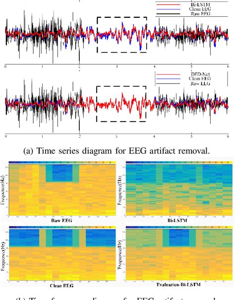 Figure 3 From A Dynamic Evaluation Denoising Network For Motion Artifacts Removal From Single