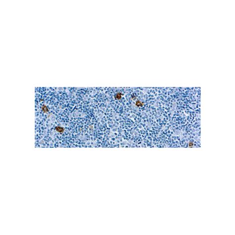 Cd15reed Sternberg Cell Marker Zebra Genetics Especialistas En