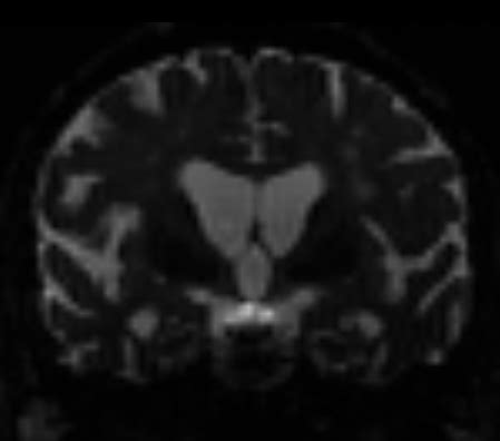 Beginner Connectome Pipeline Updated MRtrix Community