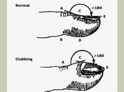 Hipocratismo El Hipocratismo Digital Podologia Ingrid