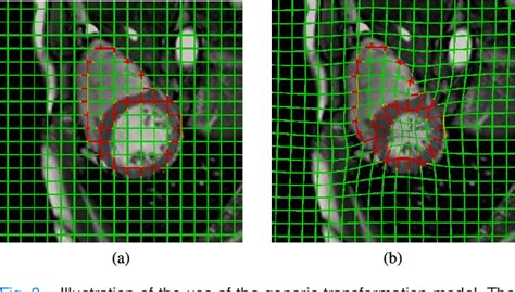 Figure 3 From A Framework For The Generation Of Realistic Synthetic Cardiac Ultrasound And