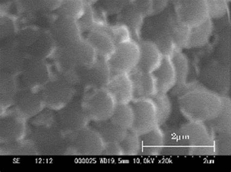 Sem Image Of C Krusei Cells Showing Reduced Gold Particles Download