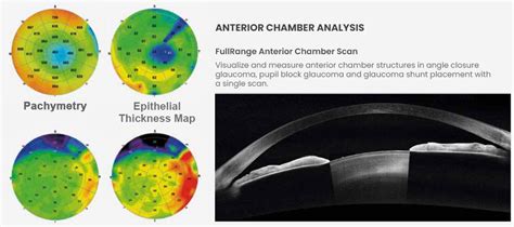 Oct 3d Scan Precision Eye Diagnostics Optimal Vision