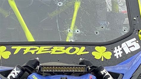 Niño De 13 Años Resulta Lesionado En Masacre En Baja California