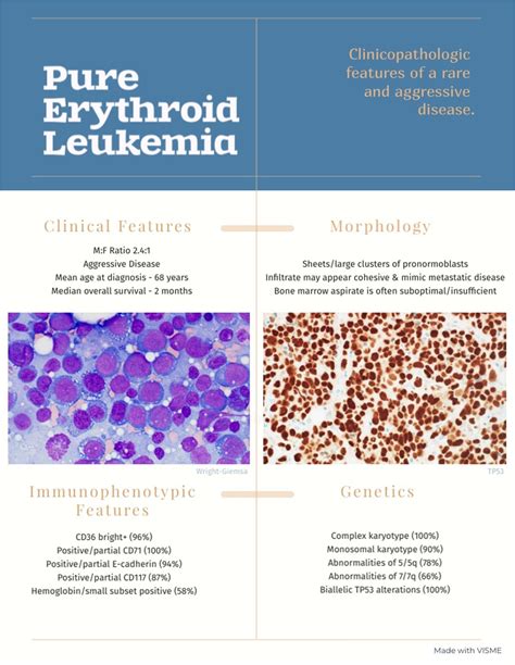 Pure Erythroid Leukemia Clinicopathologic Features Infographic