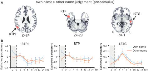 A Brain Regions Showing Greater Pre Stimulus Activity In Trials For