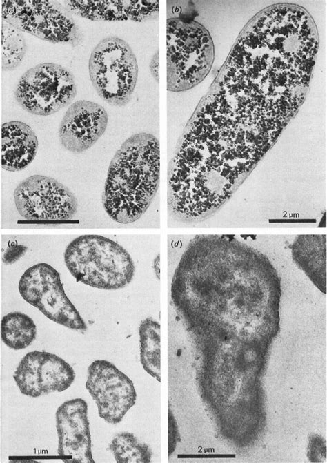 Electron Micrographs Of B Fragilis Subsp Fragilis Bb A B Cells Download Scientific
