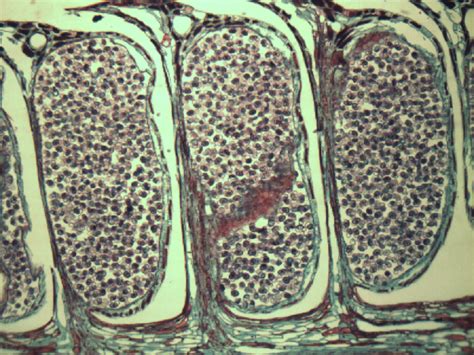 Gymnosperms Dr Peats Biology Page