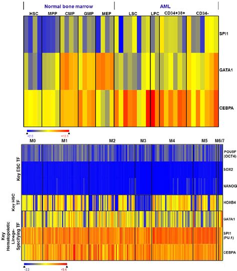 A Primary Acute Myeloid Leukemia Aml Cells Even ‘leukemia Stem Download Scientific Diagram