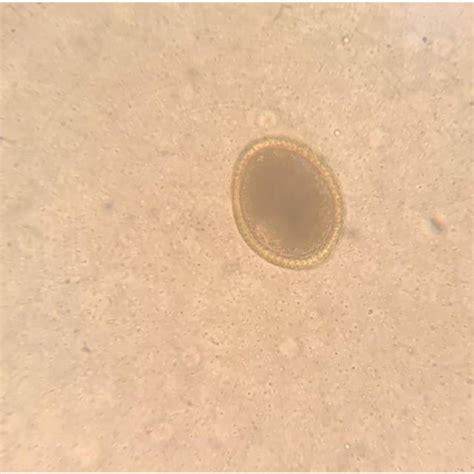 Trichuris Vulpis Egg Fecal Flotation Magnification X100 Download
