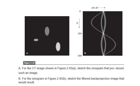 For The Ct Image Shown In Figure A Sketch The Chegg