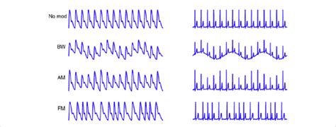 Idealised Respiratory Modulation Of Ppg Left And Ecg Right During Download Scientific