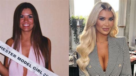 Christine McGuinness Plastic Surgery Did The RHOC Star Have A Boob Job And A Butt Lift To