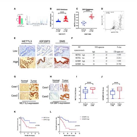Sms Promotes Pancreatic Cancer Metastasis Is Mediated Through The