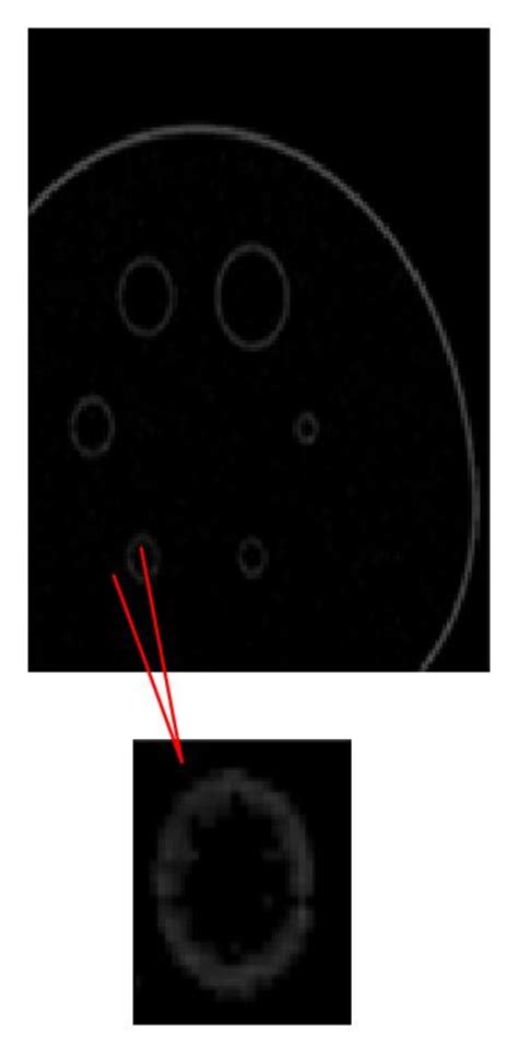 segmentation using conventional hard thresholding and curvelet based