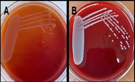 Acinetobacter On Blood Agar