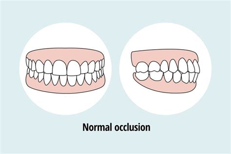 Dental Occlusion Royalty Free Images Stock Photos Pictures Shutterstock