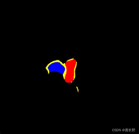 Transunet复现过程（详细过程） Csdn博客