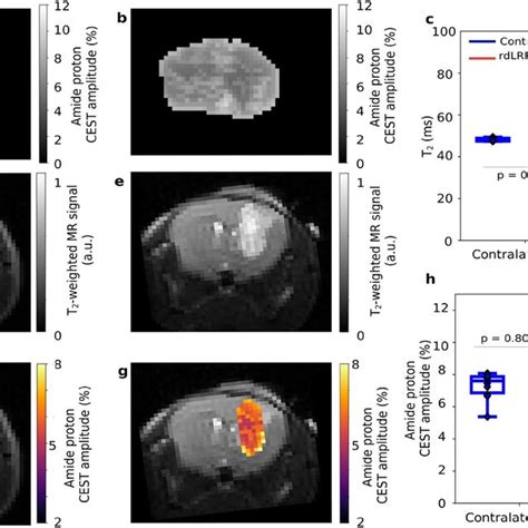 In Vivo Imaging Of The Rdlrp Ab Amide Proton Cest Amplitude Maps Of Download Scientific