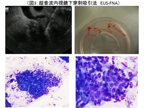 大阪医科薬科大学 第2内科（消化器内科）