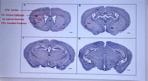 I Need Help Labeling The Nissl Stain Of Mouse Brain