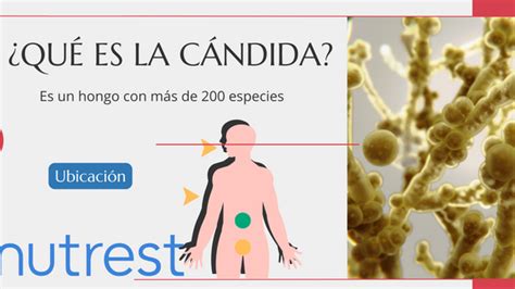 Eliminar Hongo Candida Y Perder Peso Métodos Efectivos