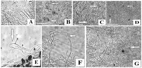 Scanning Electron Micrographs Showing Non Glandular Trichomes Of
