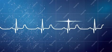 파란색 배경에 흰색 심장 박동 펄스 심전도 리듬 벡터 일러스트 레이 션 심장학에 대한 의료 Ecg 또는 Ekg 의료 생활