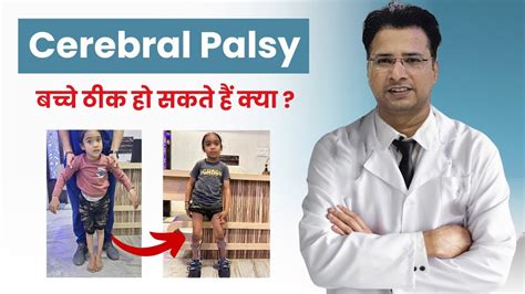 क्या सेरेब्रल पाल्सी बच्चे ठीक हो सकते हैं Cerebral Palsy L Re Life