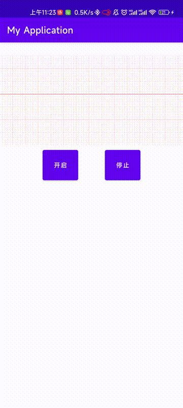 安卓实现ecg心电图功能android Ecg Monitor Csdn博客