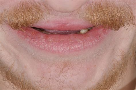 Medical Conditions Amsterdam Dental Group