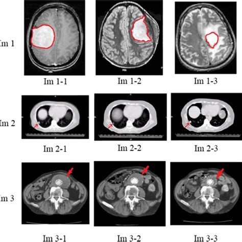 Images After The Texture Classification Download Scientific Diagram