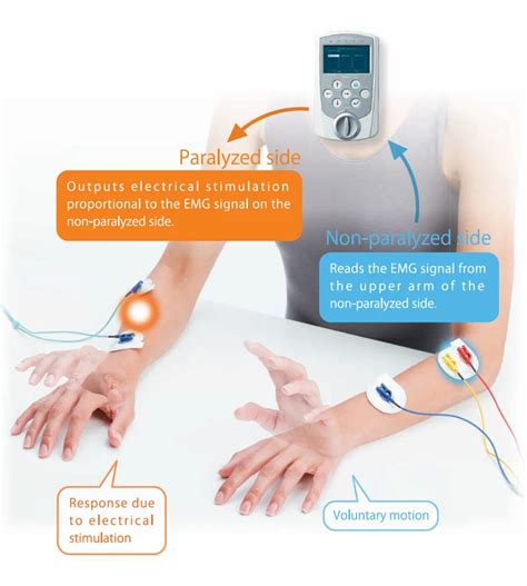 Handheld Functional Electrical Stimulator Fes Model Namenumber Gd