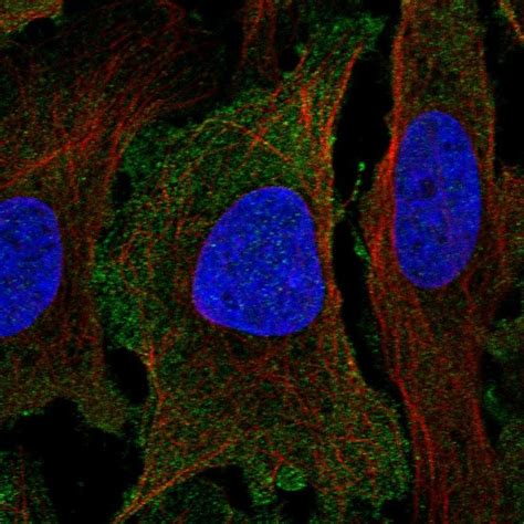 Rabbit Polyclonal Anti Per1 Antibody Buy For Research Highly