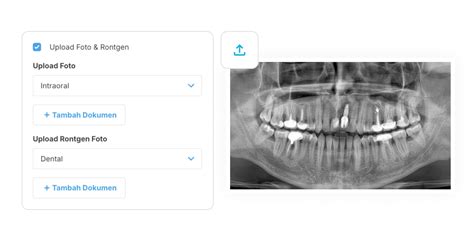 Odontogram