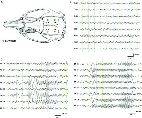 A Schematic Of Skull Screw Electrode Placement For Download Scientific Diagram A Schematic Of Skull Screw Electrode Placement For Download Scientific Diagram