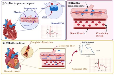 Applied Sciences Free Full Text Analysis Of A Cardiac Necrosis