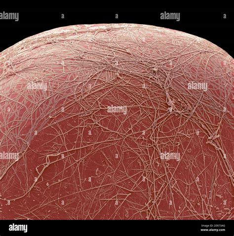Fat Cell Coloured Scanning Electron Micrograph Sem Of Part Of A Fat