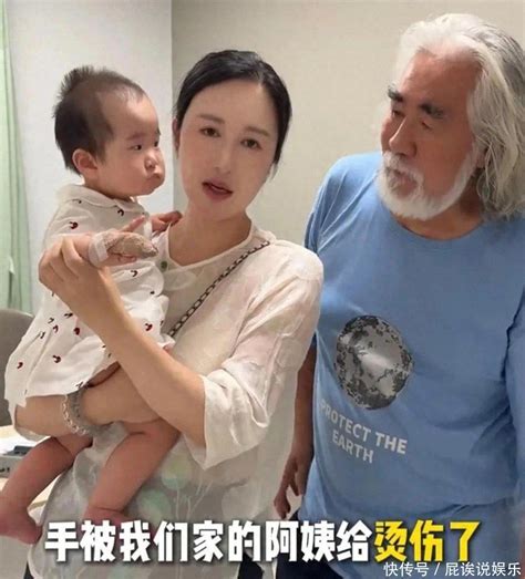 张纪中女儿被保姆烫伤！9个月小宝手指都是水泡，杜星霖快急哭了 360娱乐，你开心就好