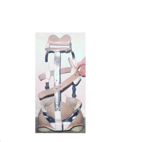 My Original Brace From 1968 Rscoliosis