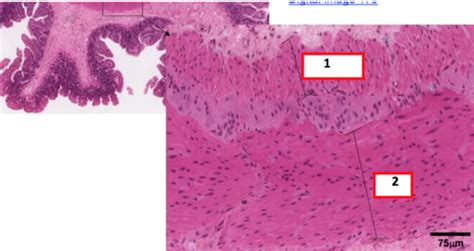 Smooth Muscle Blood Vessels Flashcards Quizlet