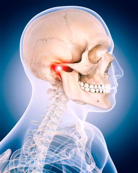 Temporomandibular Joint Syndrome Tmj Structura Body 50 Off
